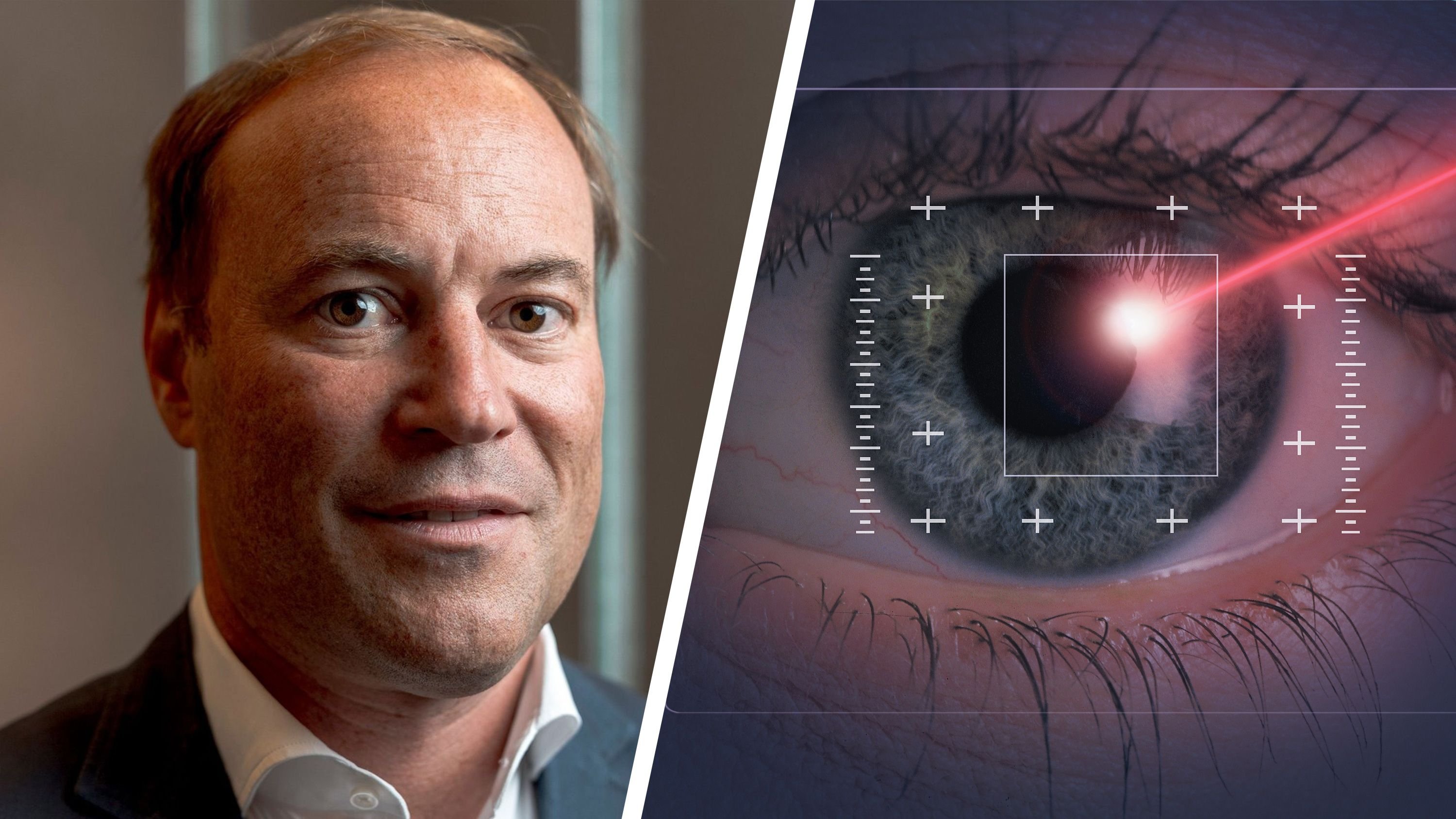 Betterview: Das Start-up erhält neue Besitzer und schliesst Filialen